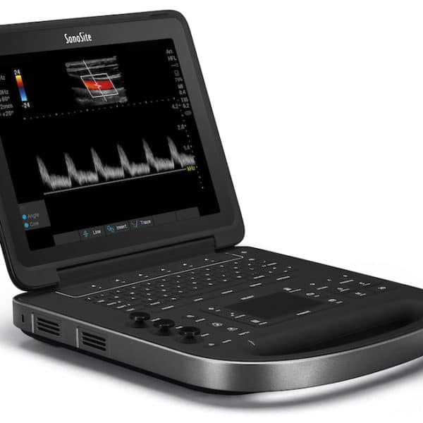 ecógrafo portátil archivos - Sonika Equipos Médicos SA de CV