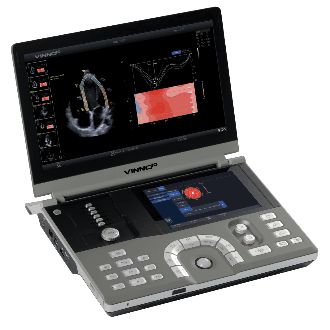 Ultrasonido Vinno 10 - Sonika Equipos Médicos SA de CV